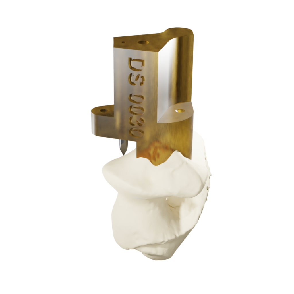 HIF - Fusion Implants