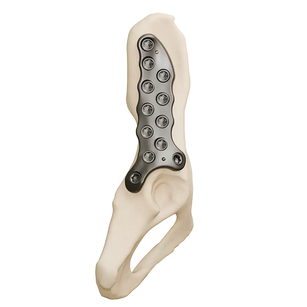 FLIP - Fusion Implants