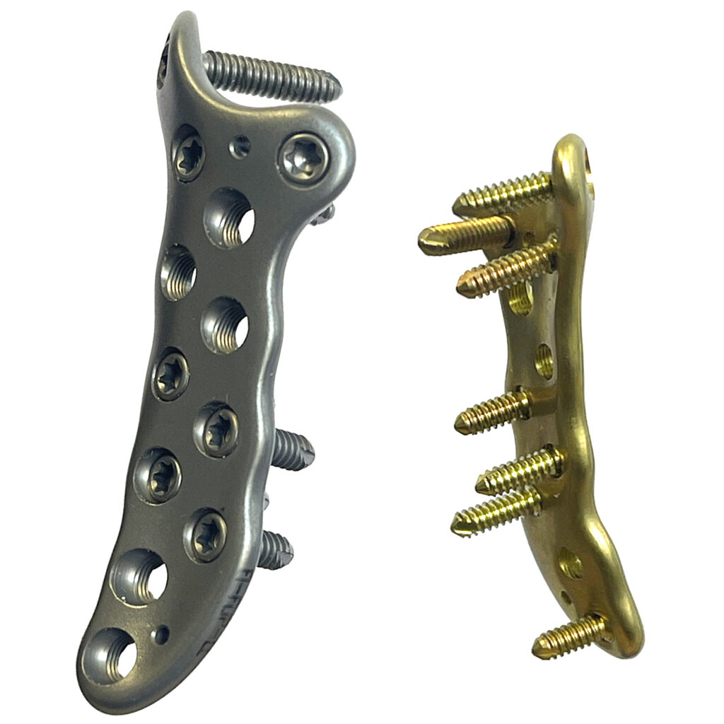 FLIP Implants - Fusion Implants