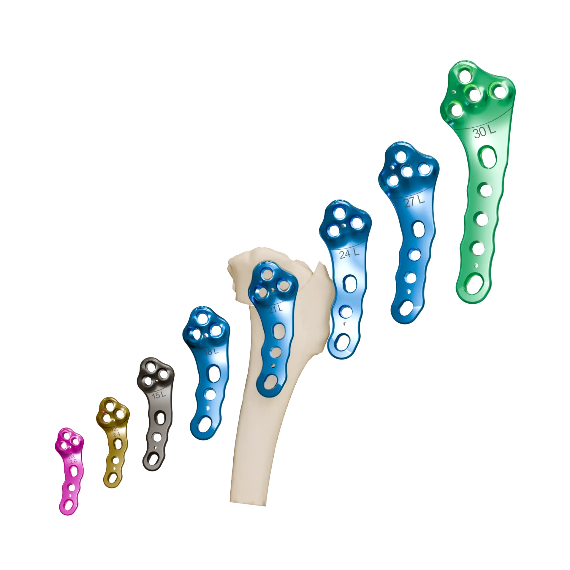 TPLO - Fusion Implants